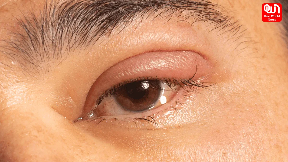 Get Rid Of Puffy Eyes After Crying With These Remedies